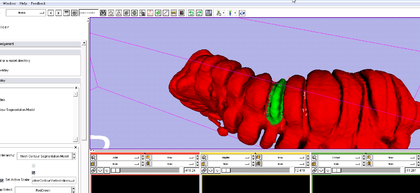 Modules:MeshContourSegmentation-Documentation-3.6 - Slicer Wiki