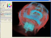 Slicer3:Volume Rendering With Cuda - Slicer Wiki