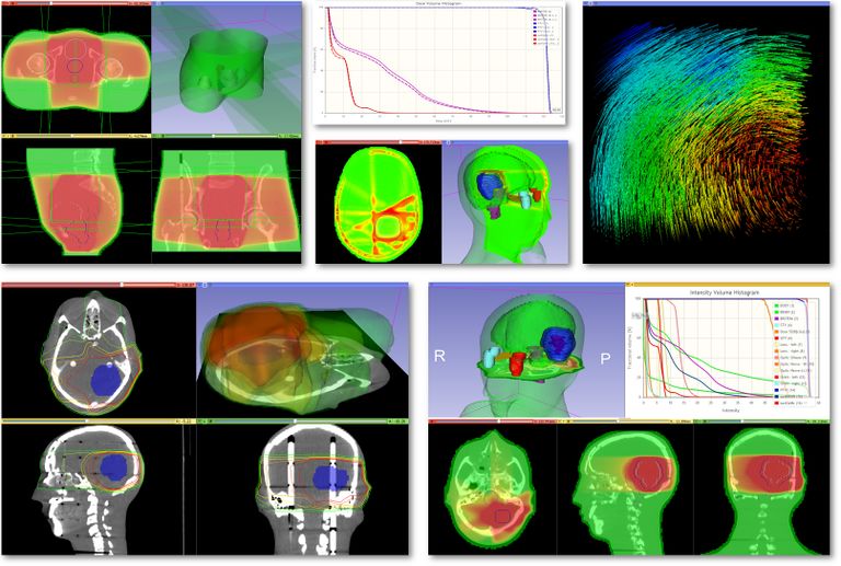Documentation/Nightly/Extensions/SlicerRT - Slicer Wiki