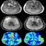 Documentation/4.10/Modules/DSC MRI Analysis - Slicer Wiki