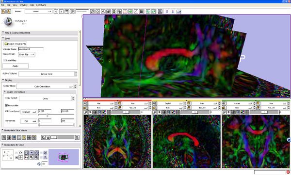 Slicer3:DTMRI - Slicer Wiki