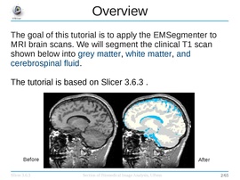 File:EMSegmenterTutorialAdvancedMode-Slicer-3.6.3-1.pdf - Slicer Wiki