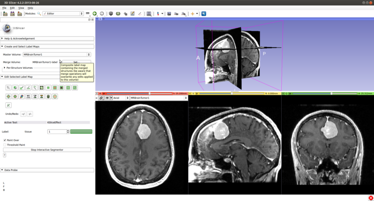 Documentation/4.4/Modules/FastGrowCut - Slicer Wiki
