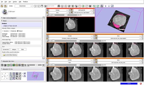 Slicer 3.6:Training - Slicer Wiki
