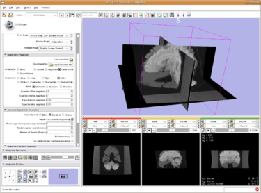 Slicer3:LinearRegistrationUseCases - Slicer Wiki