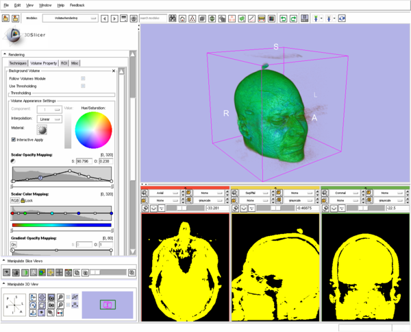 Slicer3:GPURayCaster - Slicer Wiki