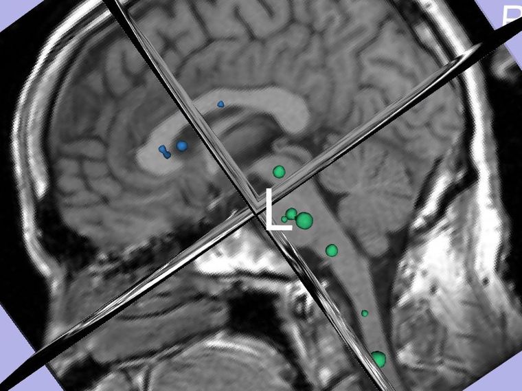 Slicer3:Module:Bubble Maker-Documentation - Slicer Wiki