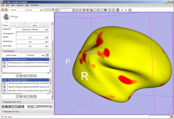 Slicer3:Module:QueryAtlas - Slicer Wiki