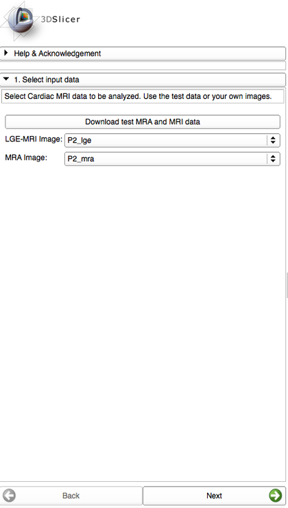 Documentation/Nightly/Modules/LASegmentationWorkflow - Slicer Wiki