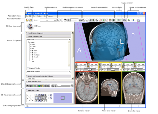 Modules:MainApplicationGUI-Documentation-3.6 - Slicer Wiki