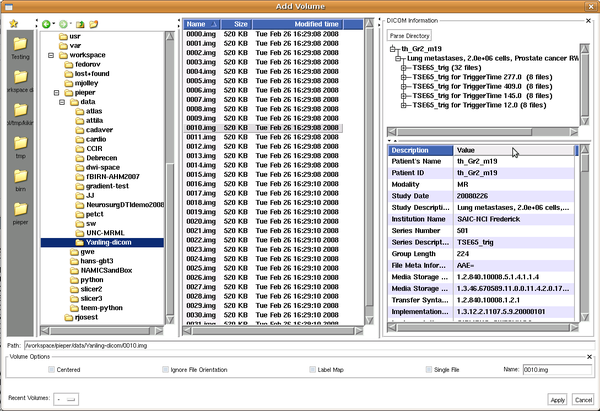 Modules:Loading-Data-3.4 - Slicer Wiki