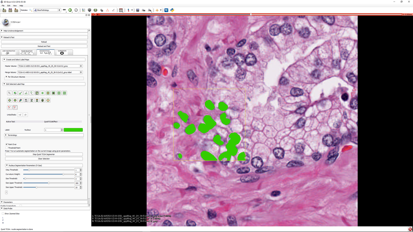 Documentation/4.10/Extensions/SlicerPathology - Slicer Wiki