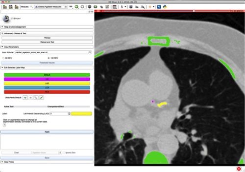Documentation/4.5/Training - Slicer Wiki