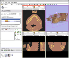 Announcements:Slicer3.6 - Slicer Wiki
