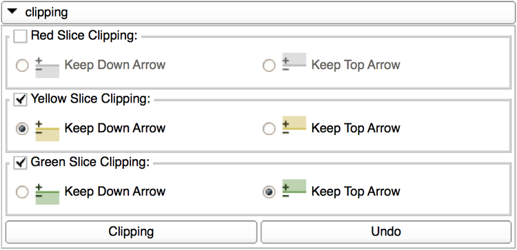 Documentation/Nightly/Modules/EasyClip - Slicer Wiki