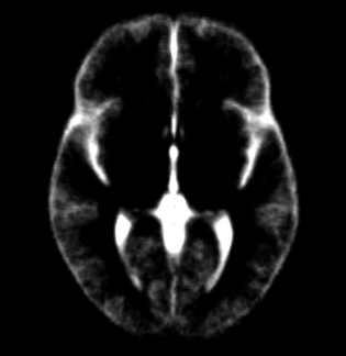 EMSegmenter-Tasks:MRI-Human-Brain-Parcellation - Slicer Wiki