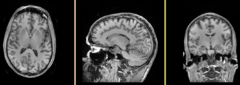 EMSegmenter-Tasks:MRI-Human-Brain-Full-Parcellation - Slicer Wiki