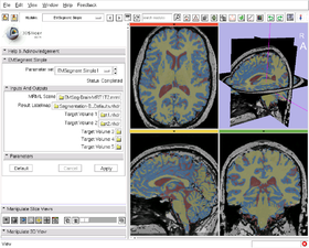 Announcements:Slicer3.6 - Slicer Wiki