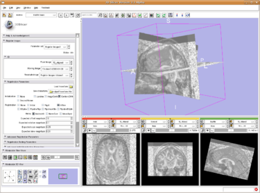 Slicer3:LinearRegistrationUseCases - Slicer Wiki