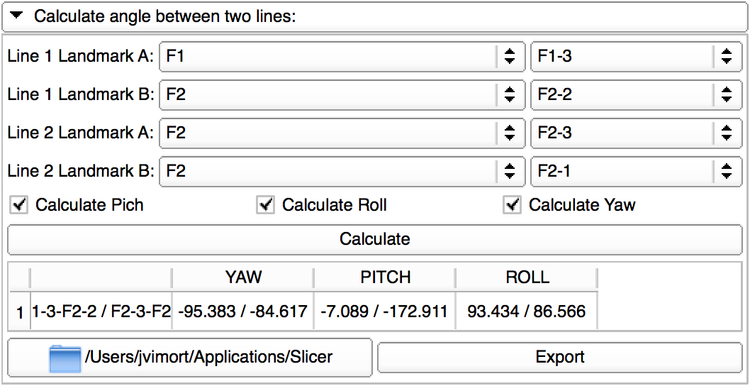 Documentation/Nightly/Extensions/Q3DC - Slicer Wiki