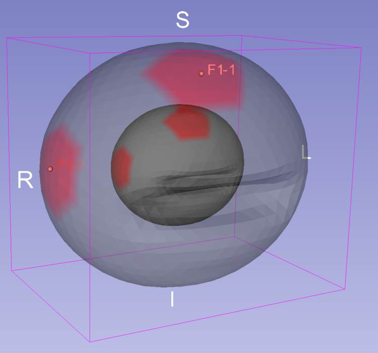 Documentation/Nightly/Modules/PickAndPaint - Slicer Wiki