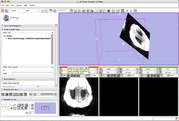 Slicer3:VisualBlog - Slicer Wiki