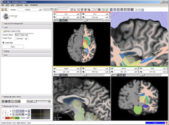 Slicer3:VisualBlog - Slicer Wiki