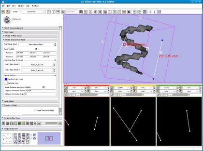 Modules:Measurements-Documentation-3.5 - Slicer Wiki