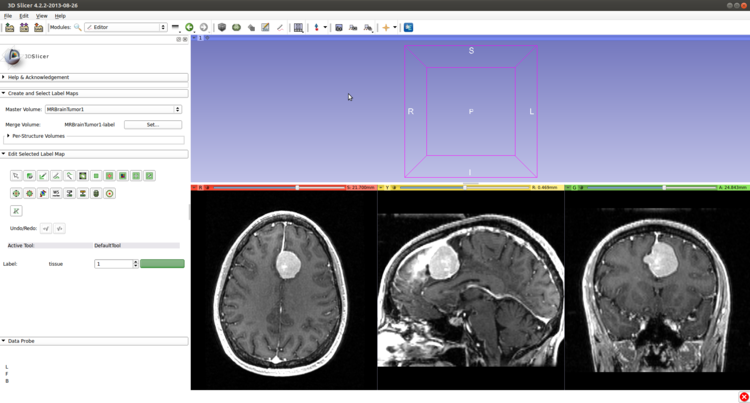 Documentation/4.8/Modules/KSliceInteractiveSegmenter - Slicer Wiki