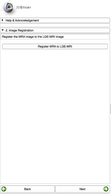 Documentation/Nightly/Modules/LASegmentationWorkflow - Slicer Wiki