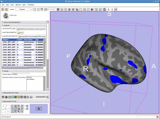 Modules:QDECModule-Documentation-3.6 - Slicer Wiki