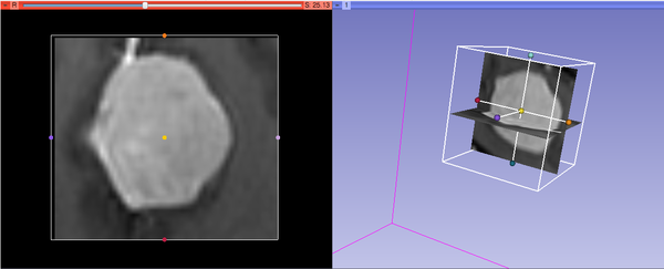 Documentation/4.4/Modules/CropVolume - Slicer Wiki