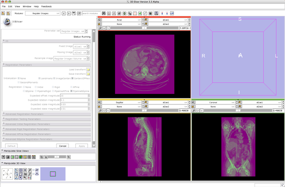 Modules:RegisterImages-Documentation-3.4 - Slicer Wiki