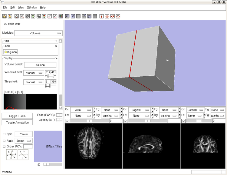 Slicer3:FiberTrackingIntegration - Slicer Wiki