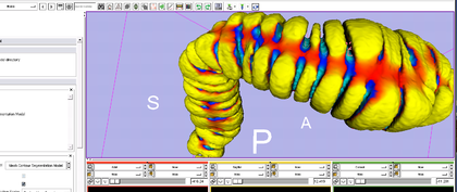 Modules:MeshContourSegmentation-Documentation-3.6 - Slicer Wiki