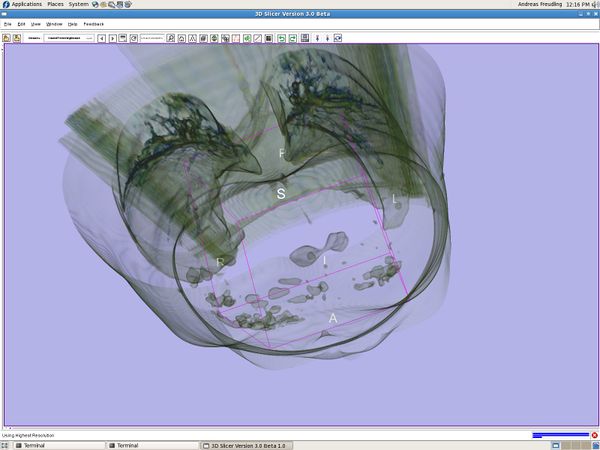Slicer3:Volume Rendering - Slicer Wiki