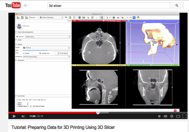 Documentation/4.6/Training - Slicer Wiki