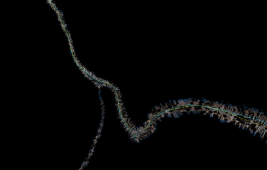 Modules:VMTK in 3D Slicer Tutorial: Coronary Artery Centerline Extraction - Slicer Wiki