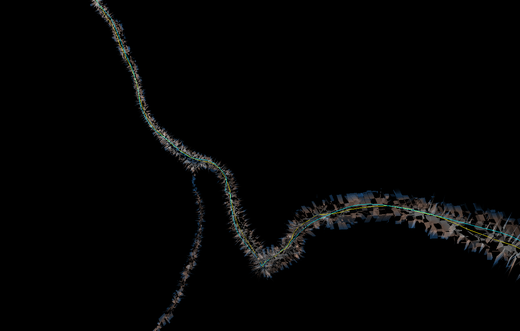 Modules:VMTK in 3D Slicer Tutorial: Coronary Artery Centerline Extraction - Slicer Wiki