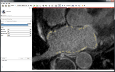 Documentation/4.4/Training - Slicer Wiki
