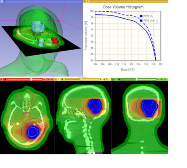 Documentation/4.4/Training - Slicer Wiki