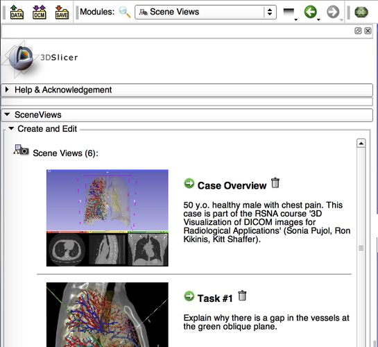 Documentation/4.4/Announcements - Slicer Wiki