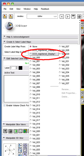 Modules:FourDAnalysis - Slicer Wiki