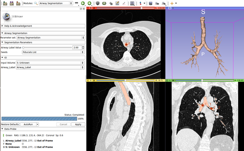 Documentation44modulesairwaysegmentation Slicer Wiki