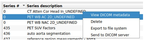 Documentation/Nightly/Modules/SUVFactorCalculator - Slicer Wiki
