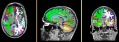 EMSegmenter-Tasks:MRI-Human-Brain-Full-Parcellation - Slicer Wiki
