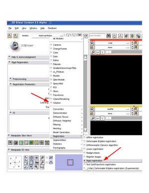 Modules:ChangeTracker-Documentation-3.4 - Slicer Wiki