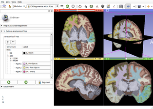 Documentation/4.0/Announcements - Slicer Wiki