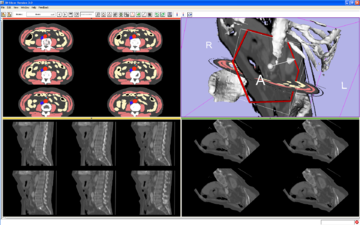 Announcements:Slicer3.2 - Slicer Wiki