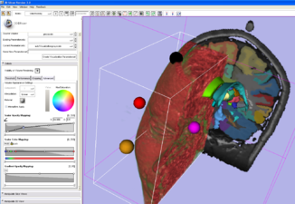 Announcements:Slicer3.2 - Slicer Wiki